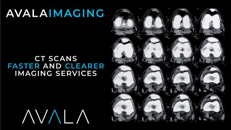 CT Scans – The Know How - AVALA
